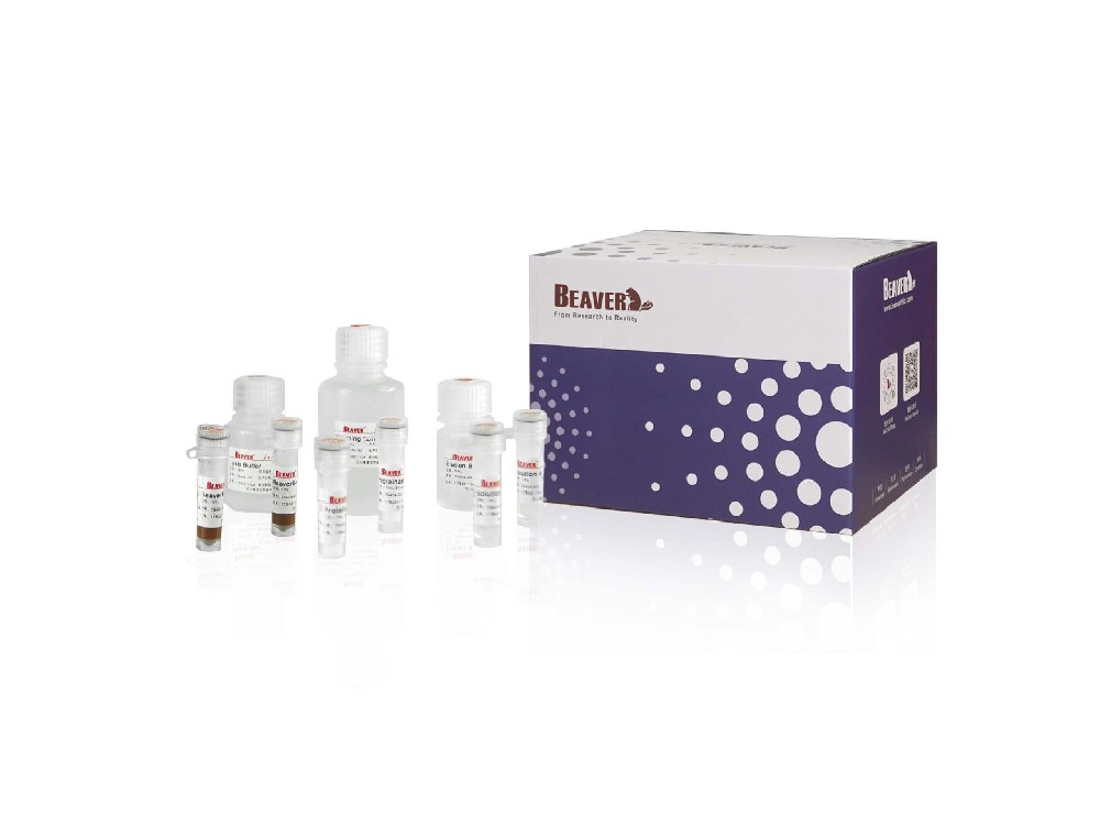 Animal Virus DNA/RNA Extraction Kit II-Series of Magnetic Beads for ...